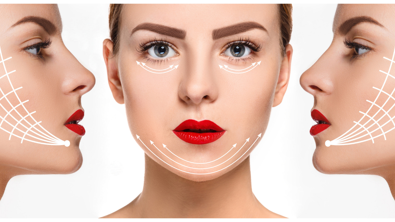 Fios de PDO - BellaKelly